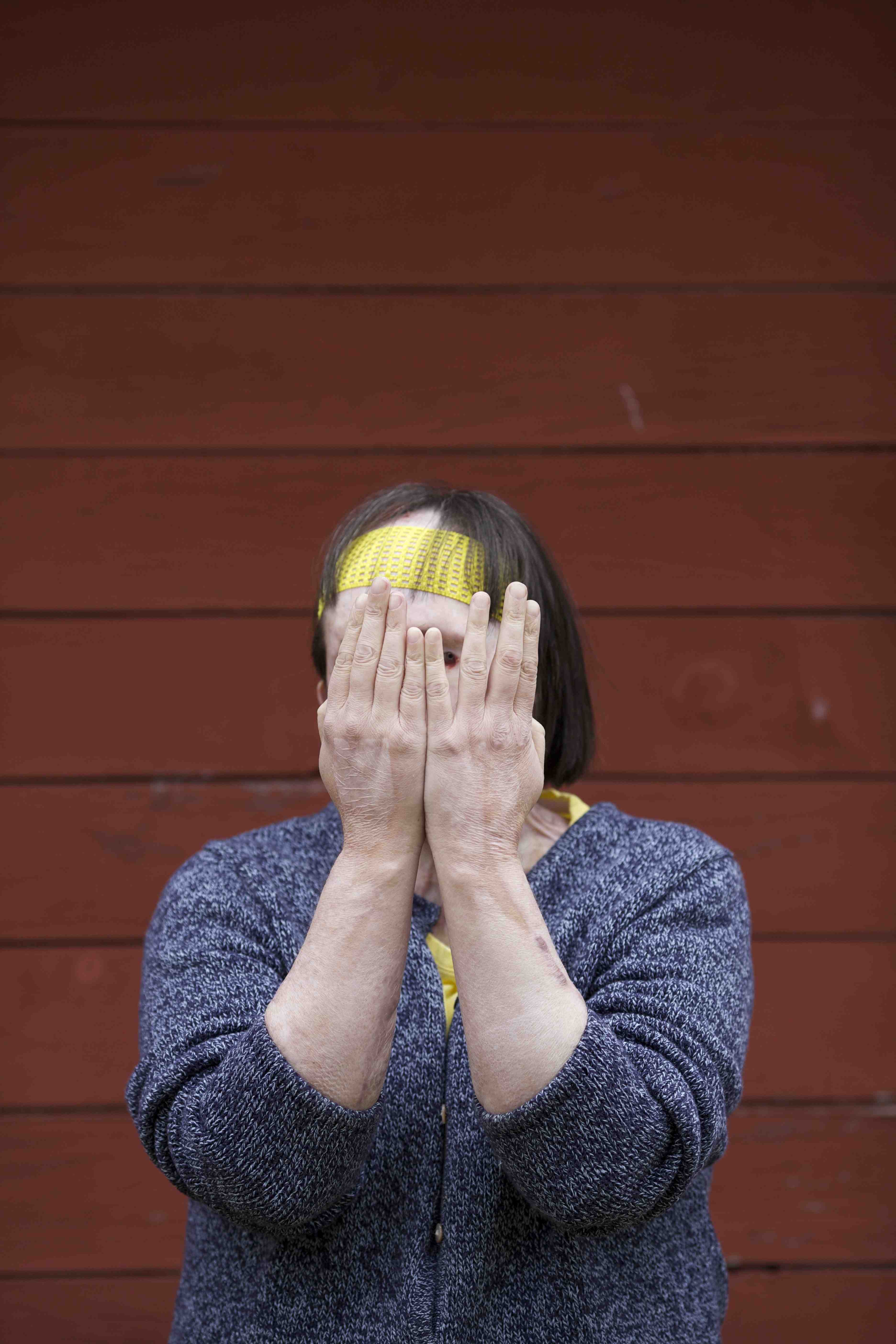 Rare Footage from Before Carmen Tarleton's Face Transplant