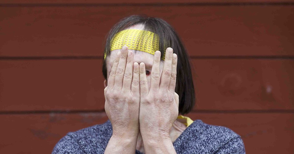 Rare Footage from Before Carmen Tarleton's Face Transplant